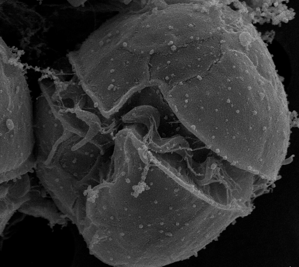 How will climate change impact harmful algal blooms? – oceanbites