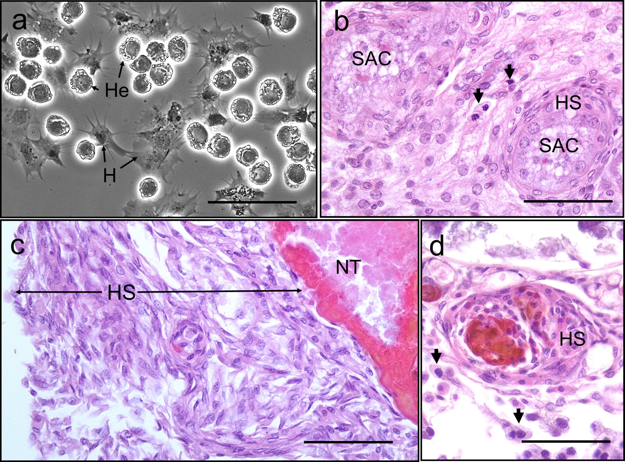 A Conundrum of Global Marine Crustacean Diseases: Bitter Crab Disease ...